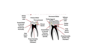 1. CLASS 1 CAVITY PREP.pptx conservative dentistry | PPT