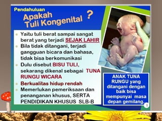 tulie konginental dan indera pendengaran | PPT