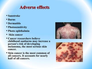 1. solar radiation.ppt desi videos for kids in the world | PPT