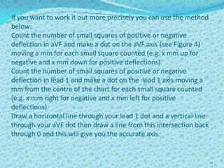 1. ECG Interpretation (basics of Electrical activity ogmf the heart).pdf