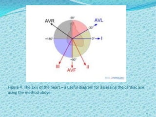1. ECG Interpretation (basics of Electrical activity ogmf the heart).pdf