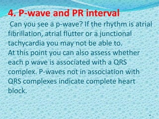 1. ECG Interpretation (basics of Electrical activity ogmf the heart).pdf