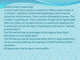 1. ECG Interpretation (basics of Electrical activity ogmf the heart).pdf