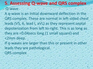 1. ECG Interpretation (basics of Electrical activity ogmf the heart).pdf