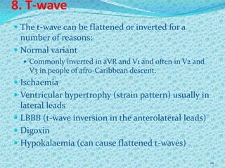 1. ECG Interpretation (basics of Electrical activity ogmf the heart).pdf