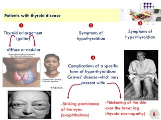 1. Hypo &Hyperthyroidism (thyroid disorders).pdf