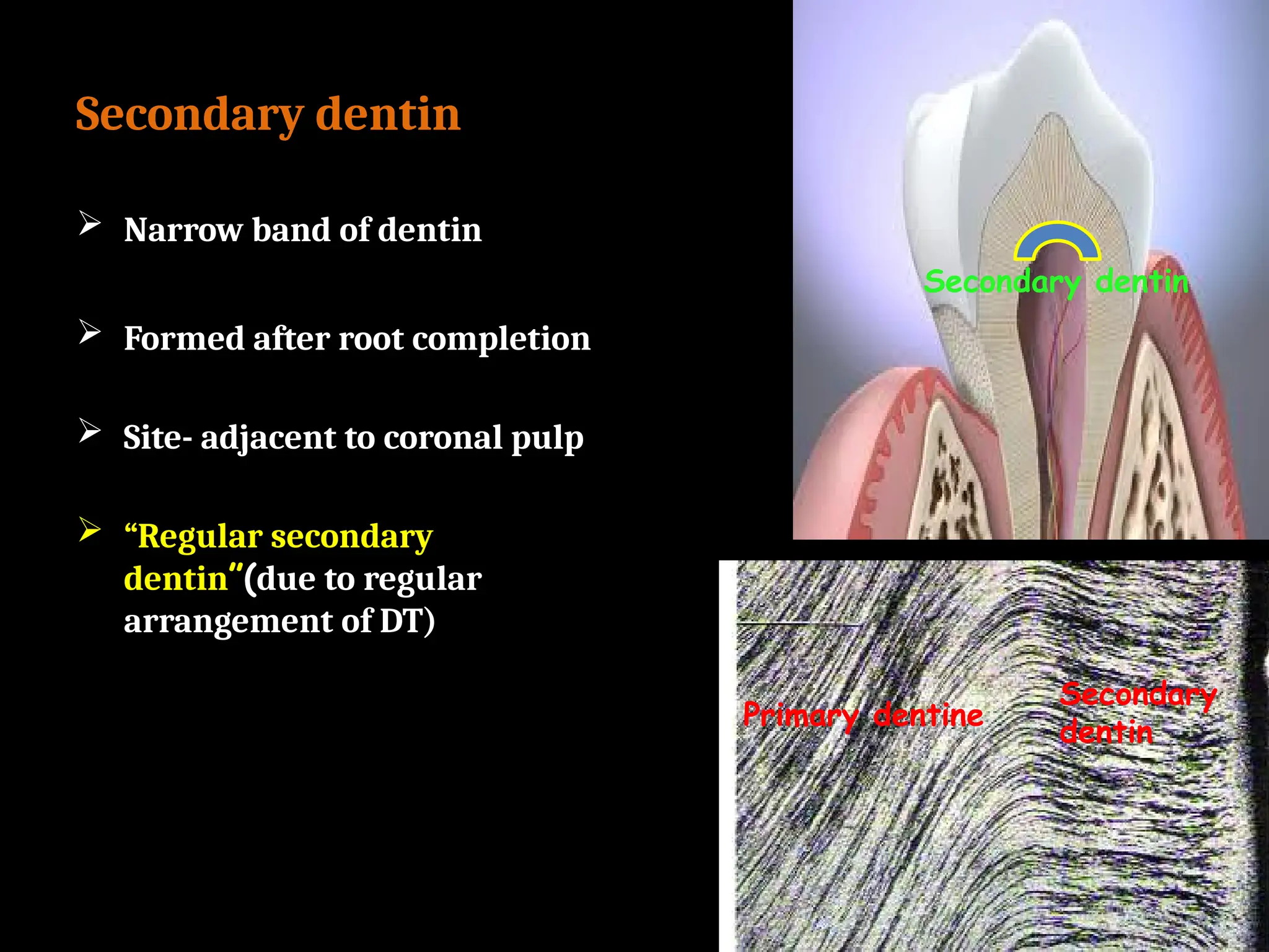 1. Dentin structure of toothtypes of dentin inter | PPTX