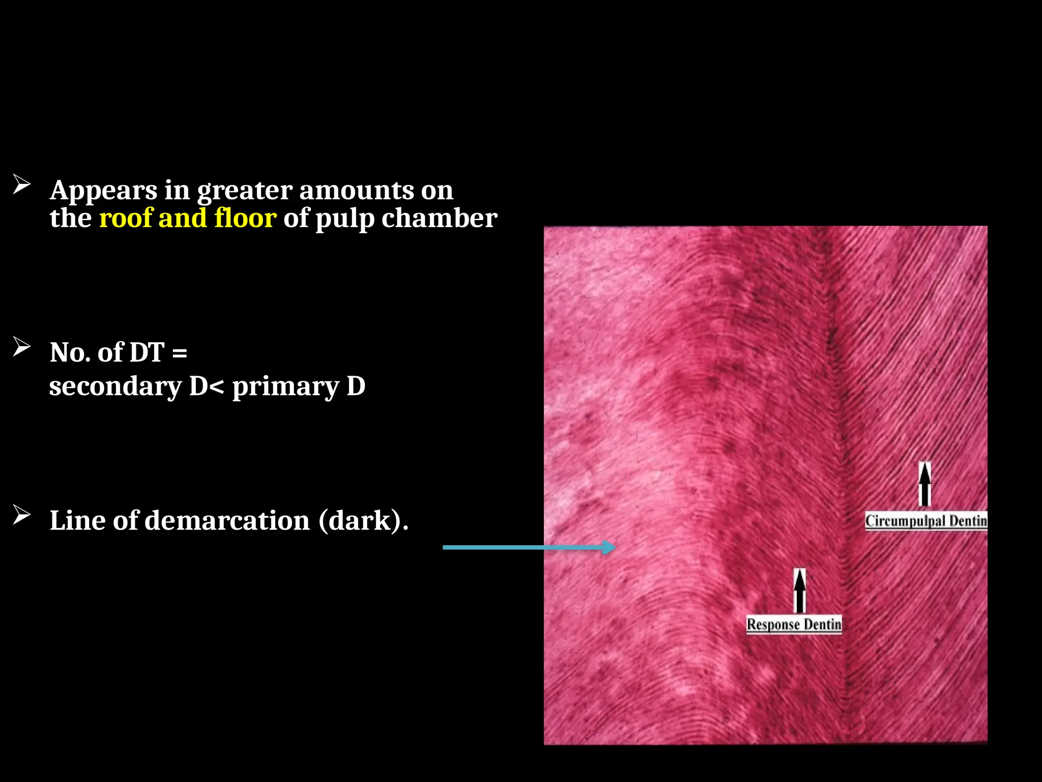 1. Dentin structure of toothtypes of dentin inter | PPTX