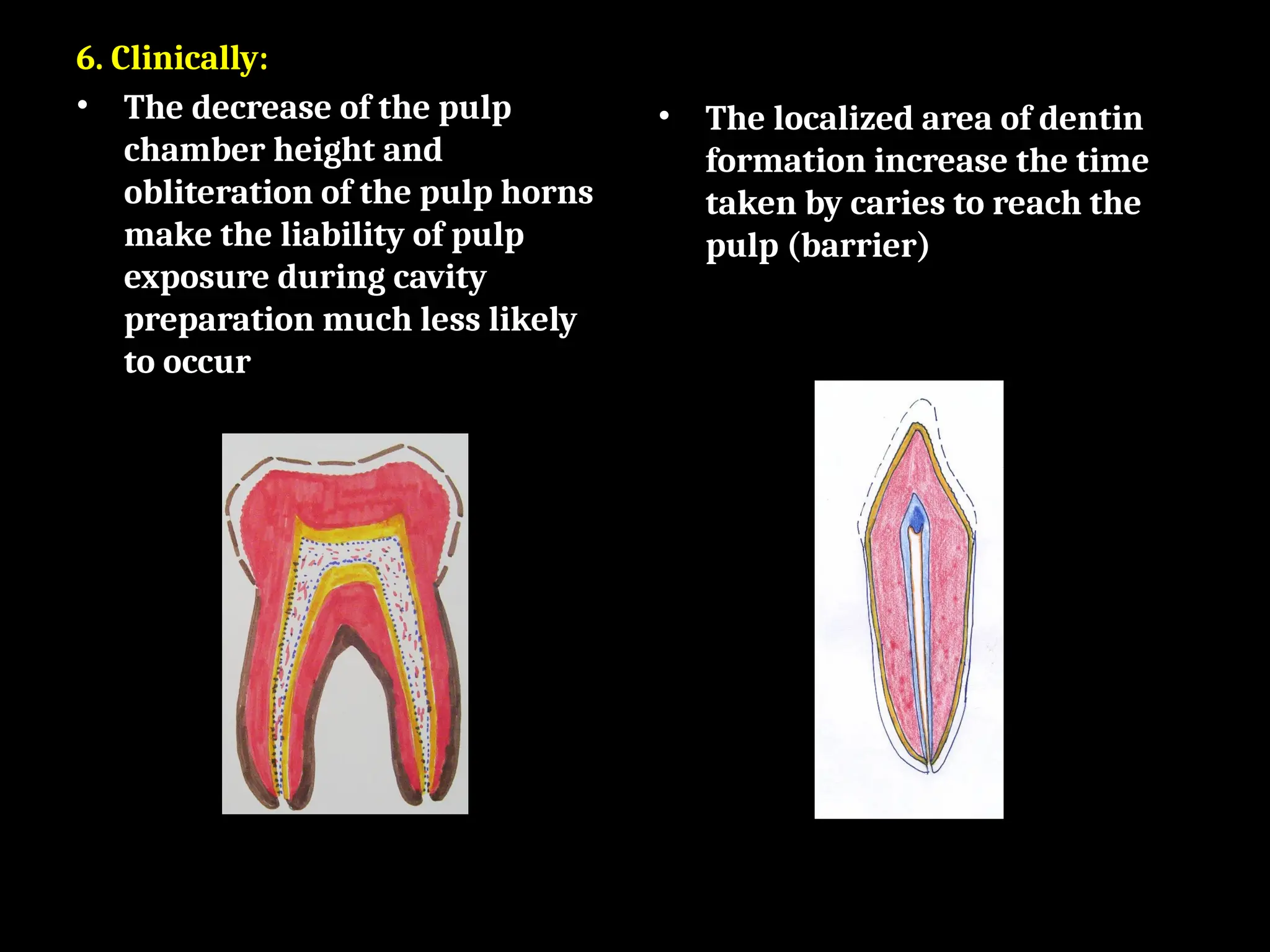 1. Dentin structure of toothtypes of dentin inter | PPTX