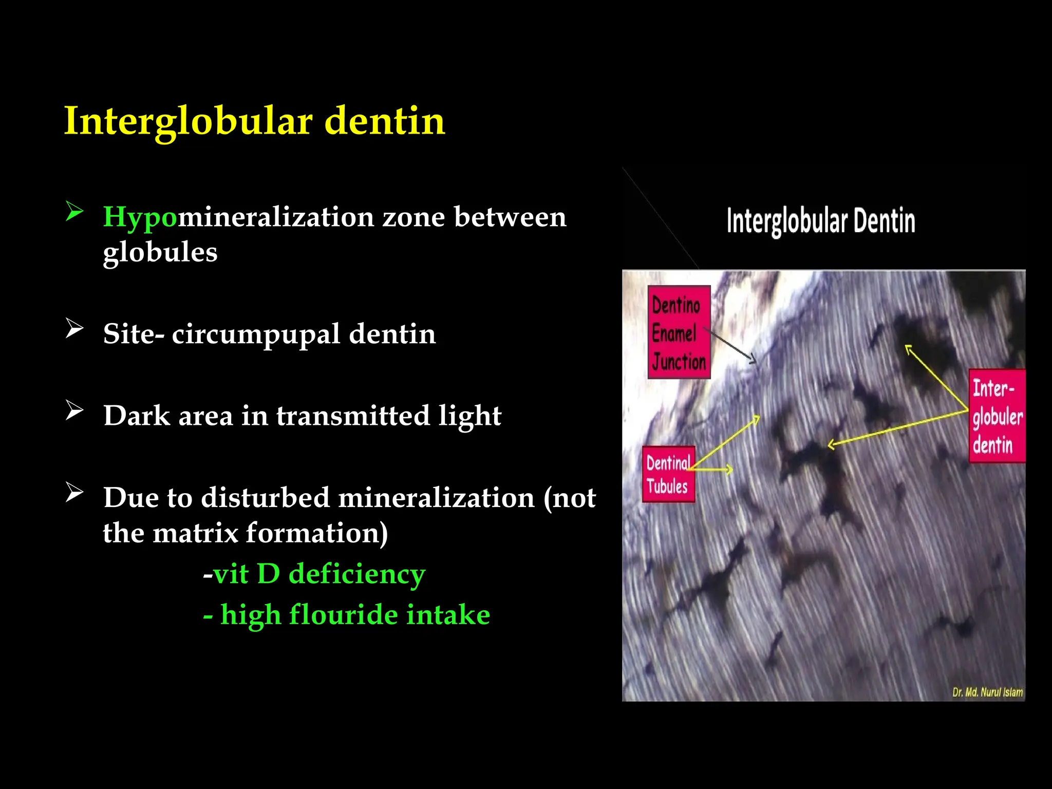 1. Dentin structure of toothtypes of dentin inter | PPTX