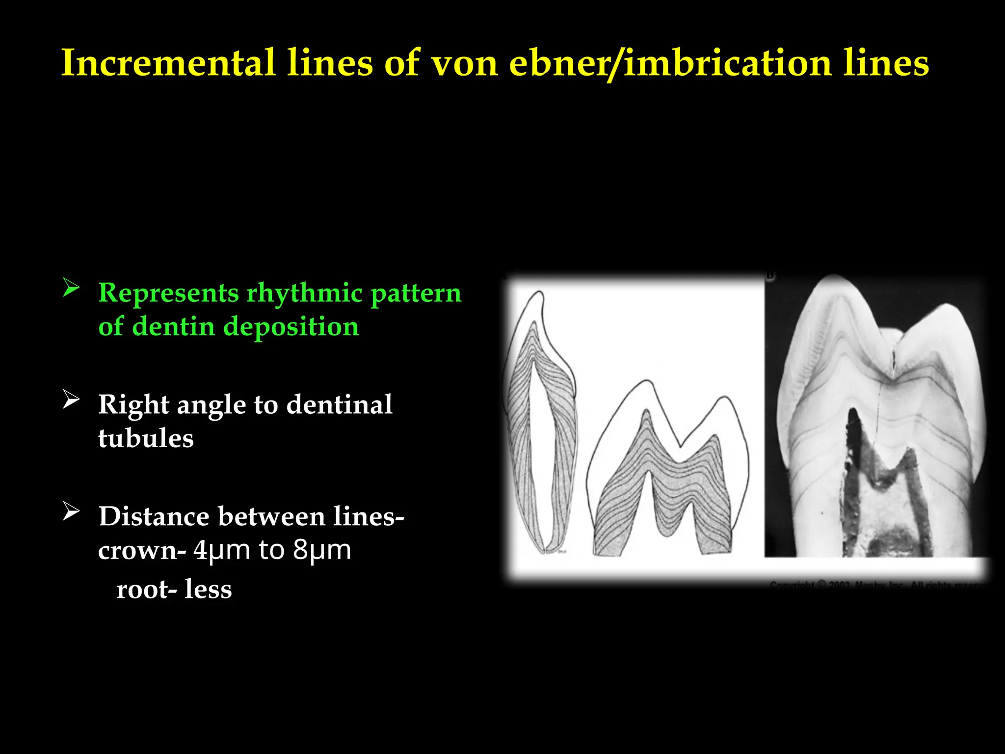 1. Dentin structure of toothtypes of dentin inter | PPTX