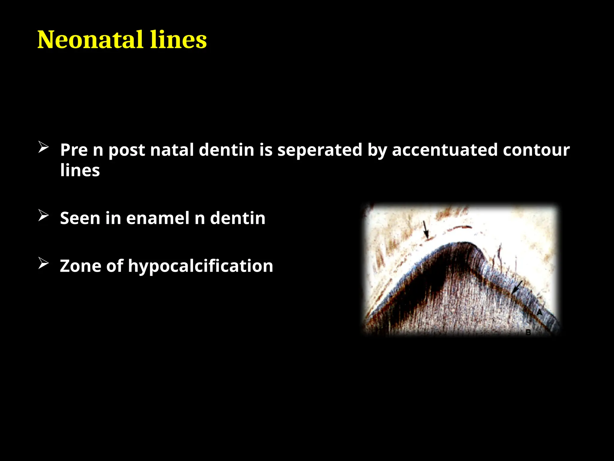 1. Dentin structure of toothtypes of dentin inter | PPT