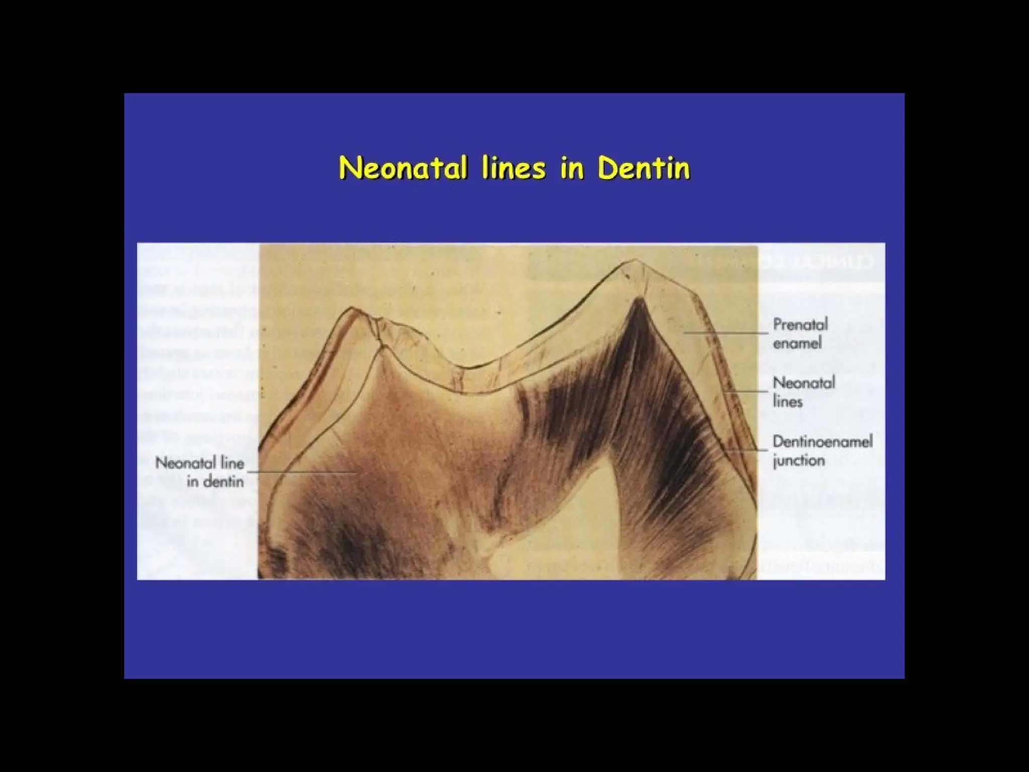 1. Dentin structure of toothtypes of dentin inter | PPT