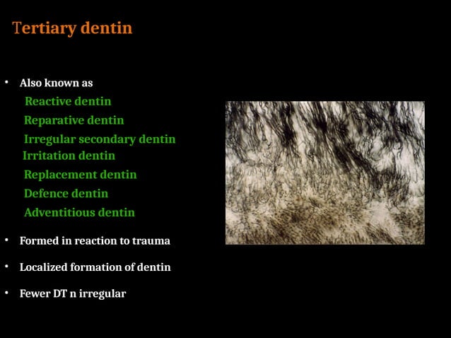 1. Dentin structure of toothtypes of dentin inter | PPT