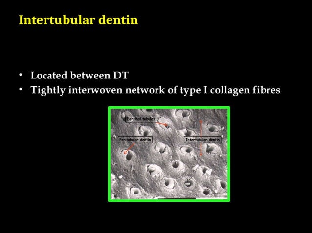 1. Dentin structure of toothtypes of dentin inter | PPT