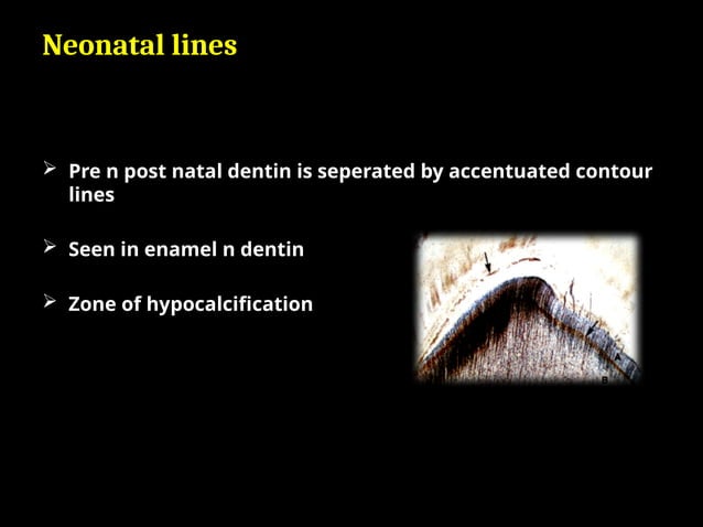 1. Dentin structure of toothtypes of dentin inter | PPT