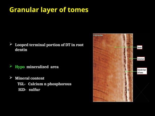 1. Dentin structure of toothtypes of dentin inter | PPT