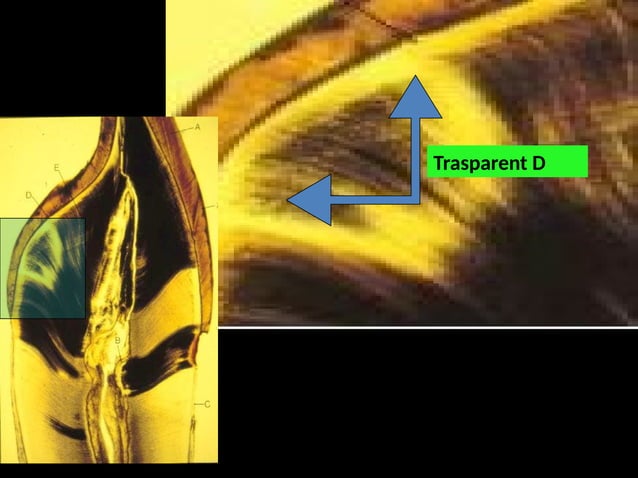 1. Dentin structure of toothtypes of dentin inter | PPT