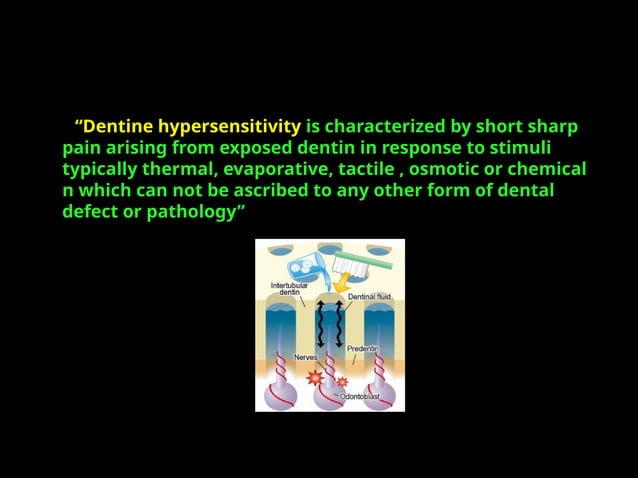 1 Dentin Structure Of Toothtypes Of Dentin Inter Ppt