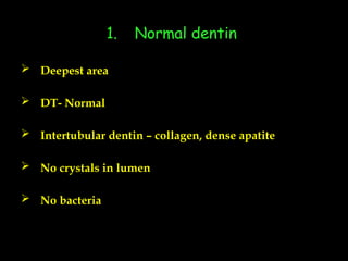 1. Dentin structure of toothtypes of dentin inter | PPTX