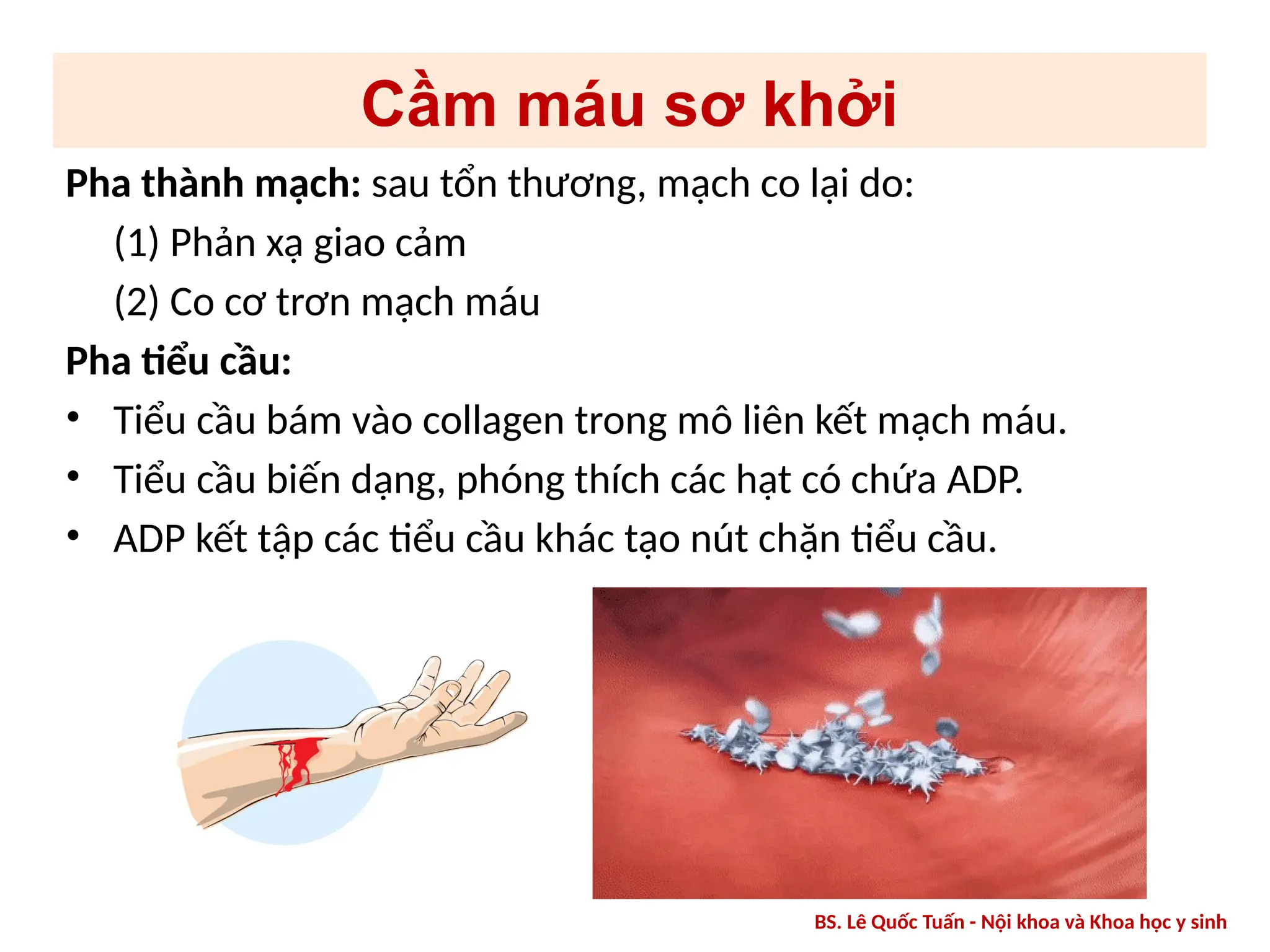 SINH LÝ BỆNH MÁU (Le Quoc Tuan, MD, MSc) | PPTX