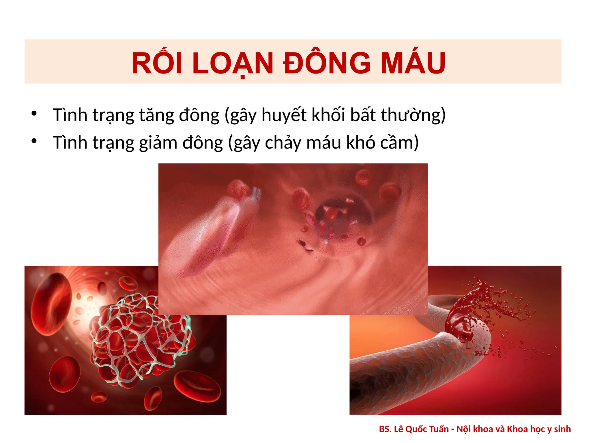 SINH LÝ BỆNH MÁU (Le Quoc Tuan, MD, MSc) | PPTX