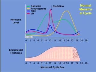 1. Polycystic Ovarian Syndrome ( PCOS ).ppt