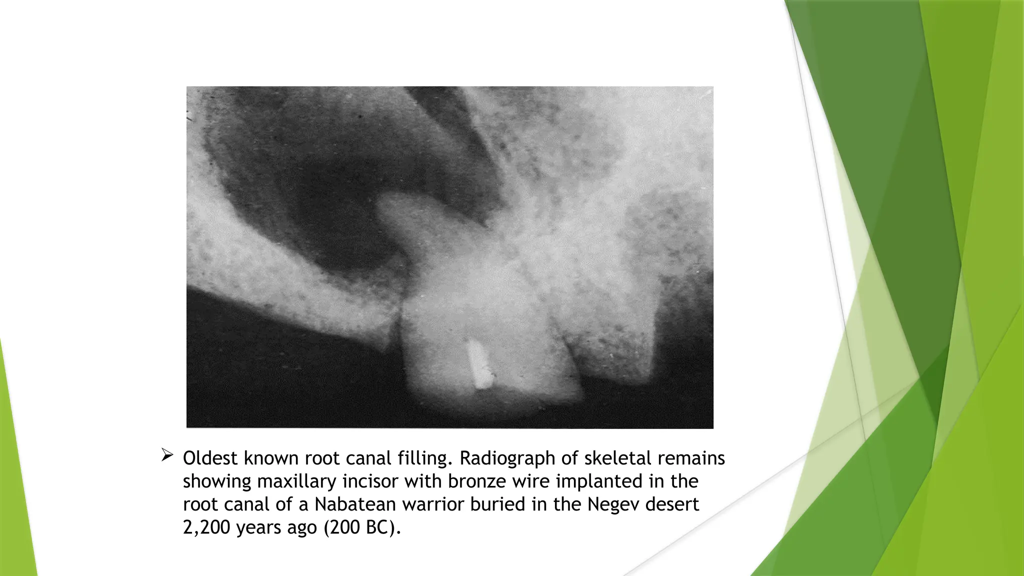 1. Introduction to endodontics 2.pptx