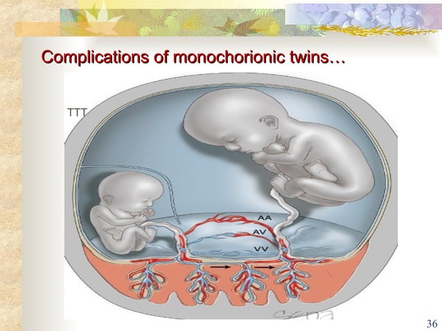 1. Multiple pregnancy & its complication.ppt