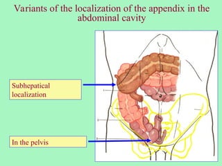 it is an inflammation of the vermiform appendix | PPT