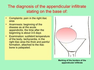 Complications of acute appendicitis refer to adverse outcomes resulting ...