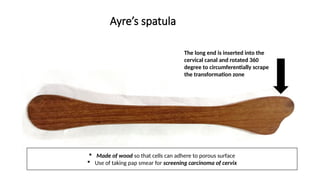 1. Ayre's spatula, carcinoma cervix.pptx