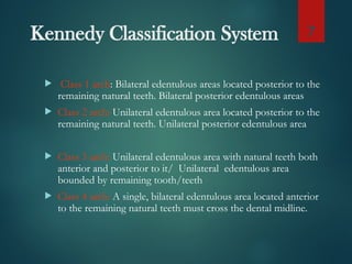 Classification of edentulous arches.ppt