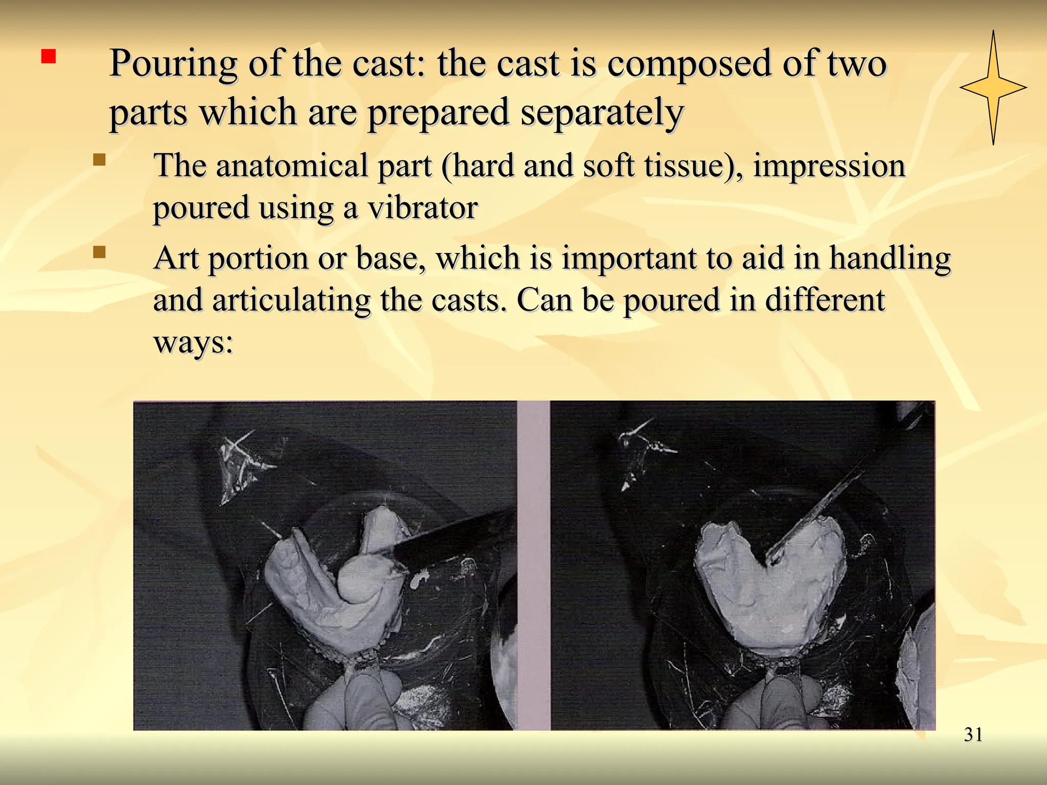 gypsum product in dental materials ppt in | PPT