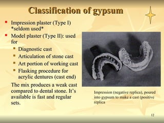 gypsum product in dental materials ppt in | PPT
