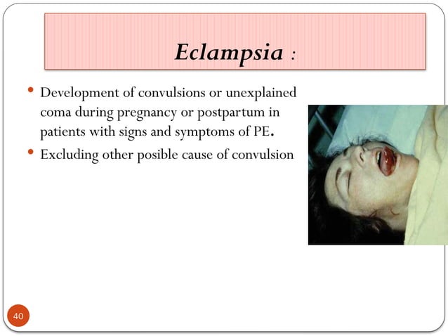 1.Management of preeclampsia and Eclampsia.pptx