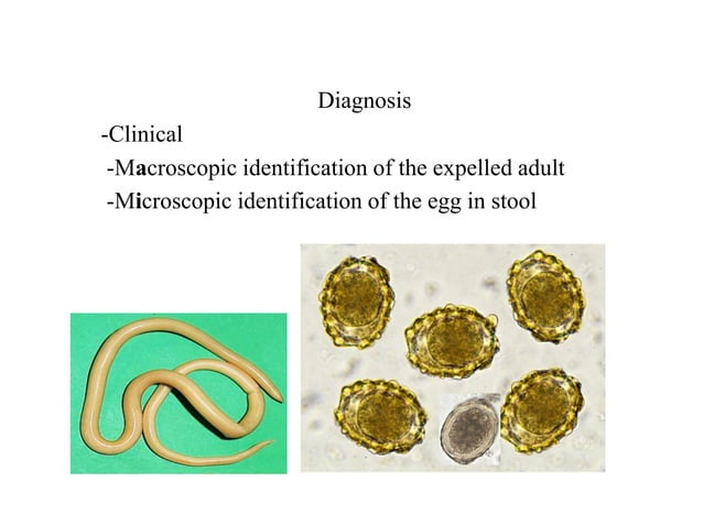 1. Ascariasis-1.pdf the lifecycle diagnosis the prevention and treatment | PPT