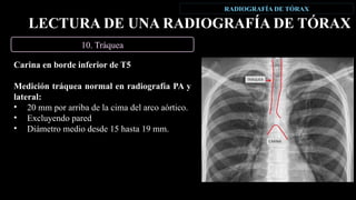 Radiografía tórax - hallazgos normales | PPTX