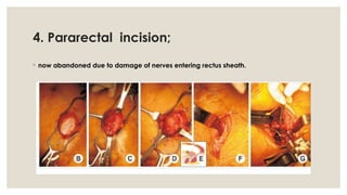 1.Surgery and indications ,incision its typespptx | PPTX