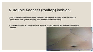 1.Surgery and indications ,incision its typespptx | PPTX