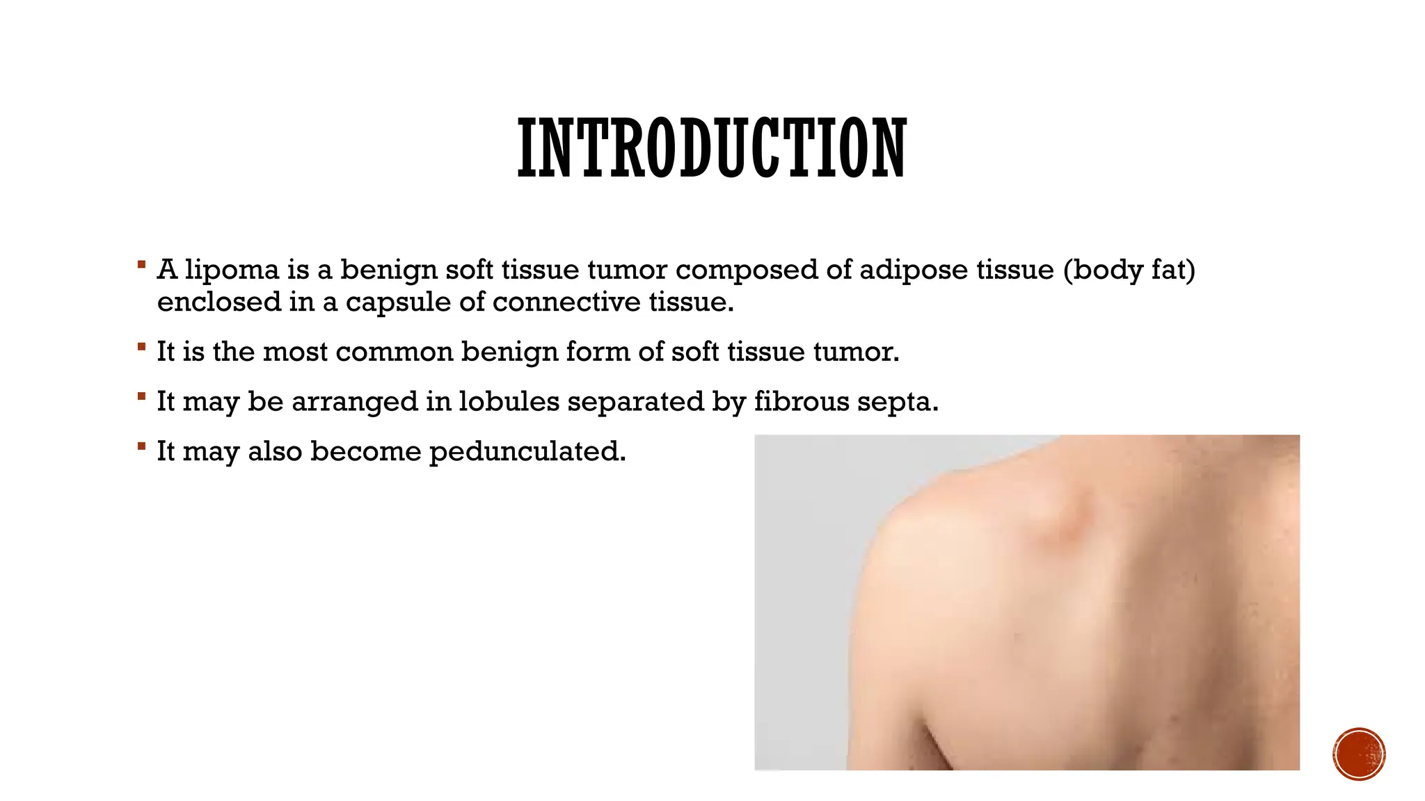 1. LIPOMA & LIPOSARCOMA what differ.pptx