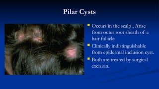 1. tumors and cancers of the skinnn.pptx