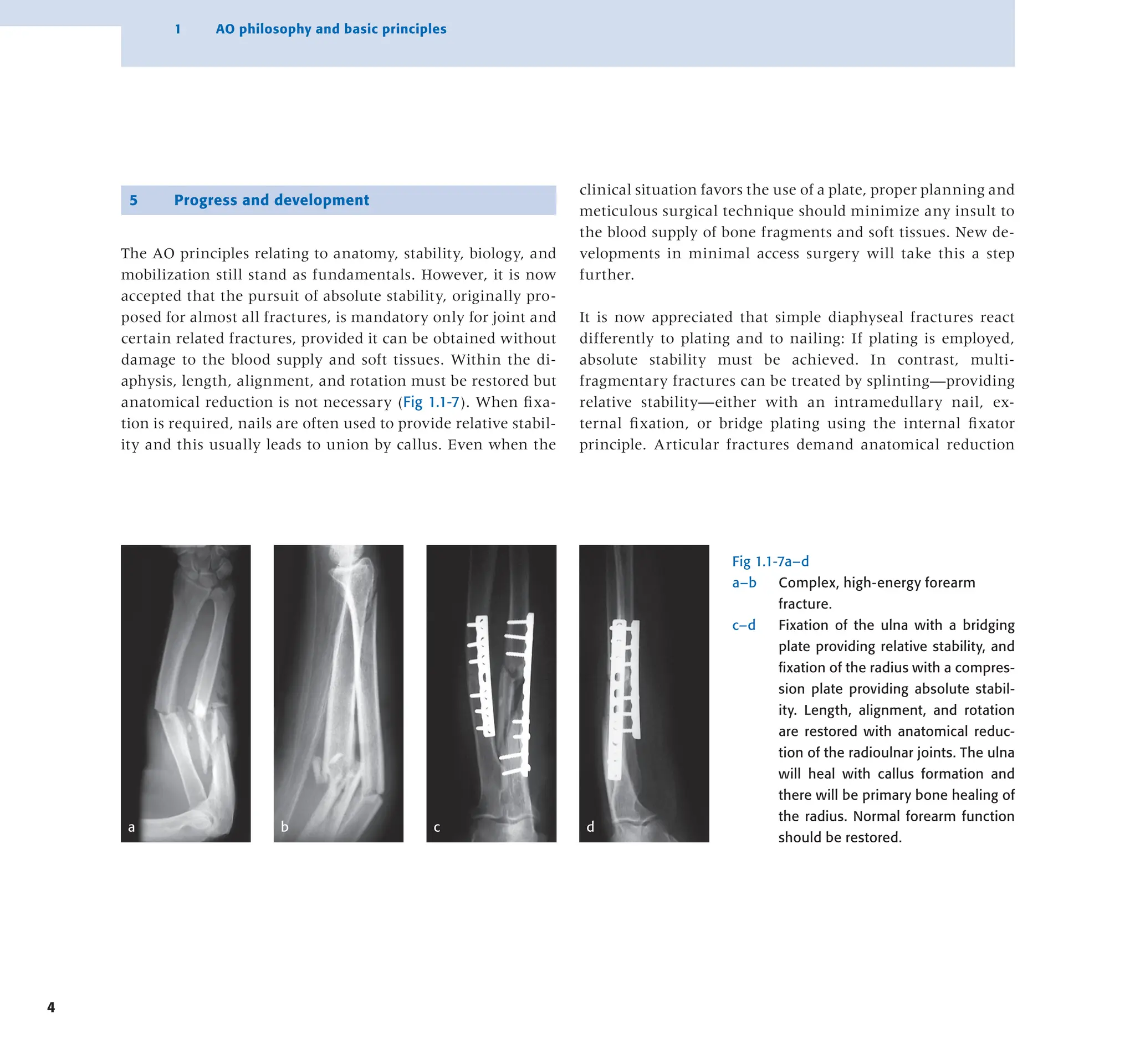 AO Trauma orthopaedic principle of fracture management .pdf