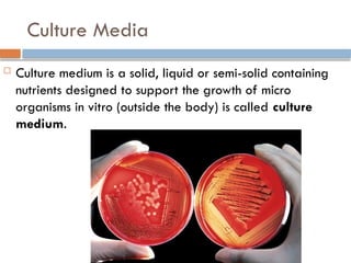 Culture Media their types and uses in diagnosis | PPTX