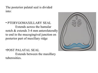 1. Maxillary-Landmarks PROSTHODONTICS .ppt