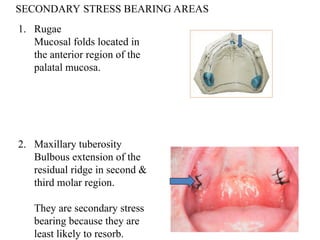 1. Maxillary-Landmarks PROSTHODONTICS .ppt