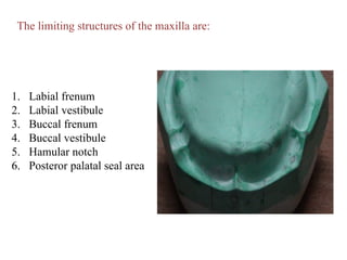1. Maxillary-Landmarks PROSTHODONTICS .ppt