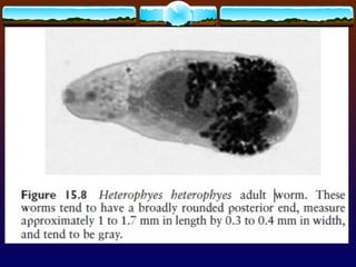 Intestinal Trematodes cause mode of transmission and treatment | PPT