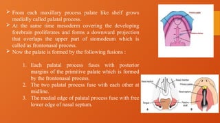 Development of palate and applied anatomy.pptx