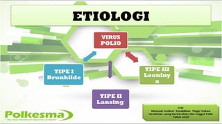 Pengenalan mengenai penyakit polio pada anak dan balita | PPTX